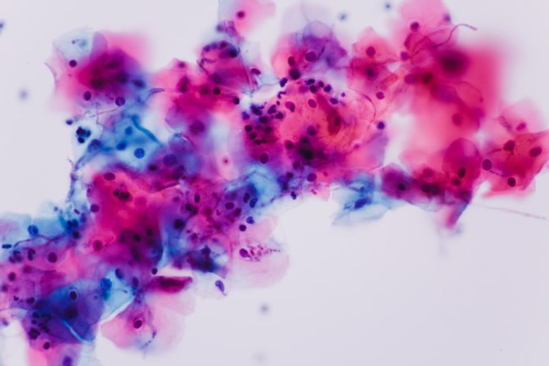 Des types d’infection buccale et dentaire | Clinique St-Charles